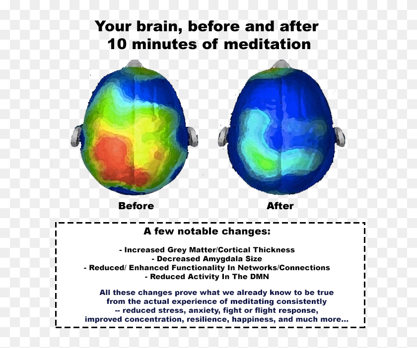 A Few Notable Changes - Brain Before And After 10 Minute Meditation, HD ... A Few Notable Changes - Brain Before And After 10 Minute Meditation, HD ...